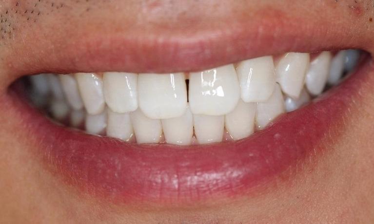 Dentist Vienna VA | Smile Gallery | Tysons Dentistry 22182